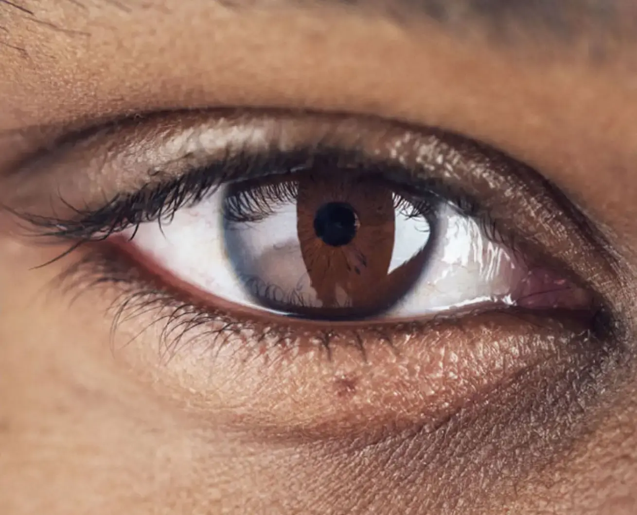 Raising Our Sights | Fighting Blindness Canada