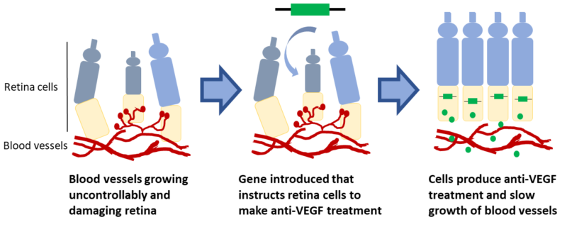 Gene Therapy & Clinical Trials to Treat Vision Loss | Fighting ...