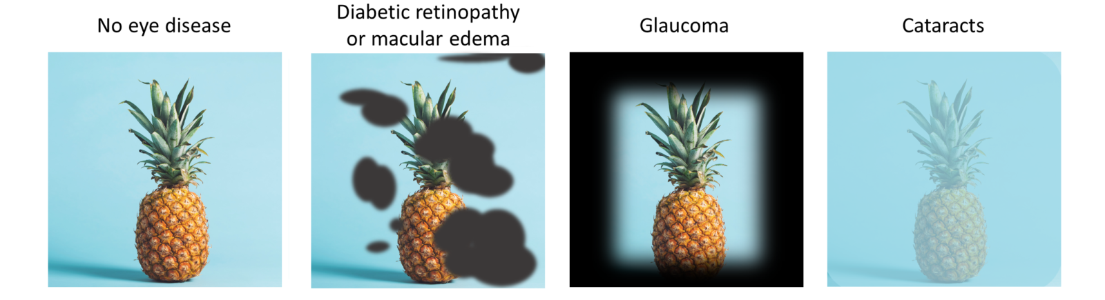 Diabetes & Vision Loss | Fighting Blindness Canada (FBC)